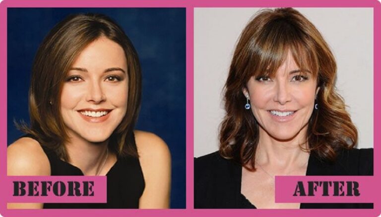 Christa Miller Plastic Surgery, Before & After Pics, Age