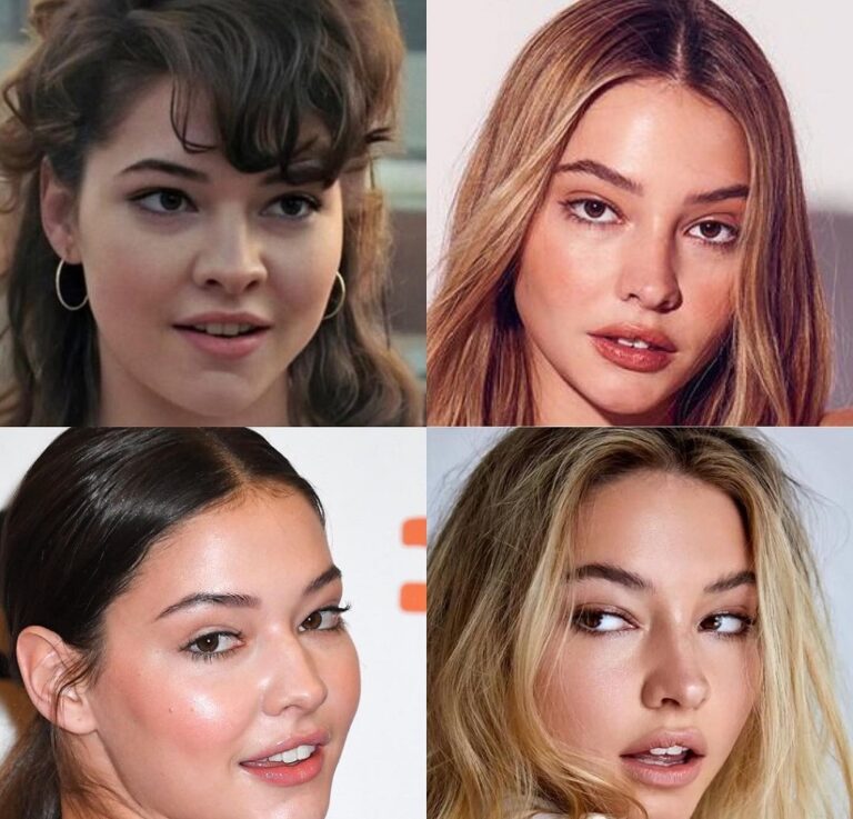 Madelyn Cline Before And After Plastic Surgery