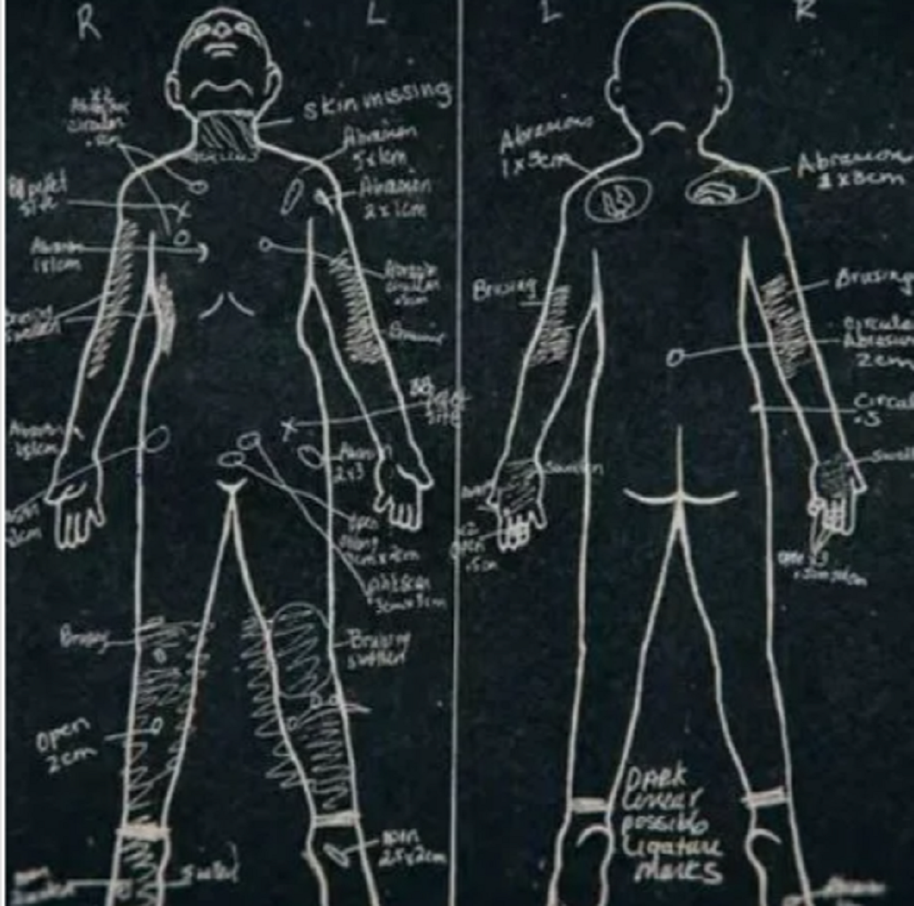 Gabriel Fernandez Autopsy Report, How Did He Die? Age