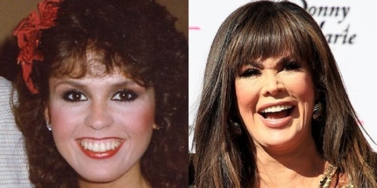 Marie Osmond Facelift And Plastic Surgery Before And After