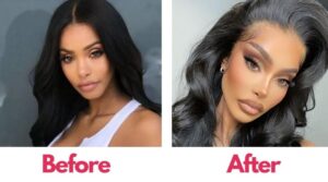 Model Yodit Yemane Plastic Surgery, Before And After Pics Ag
