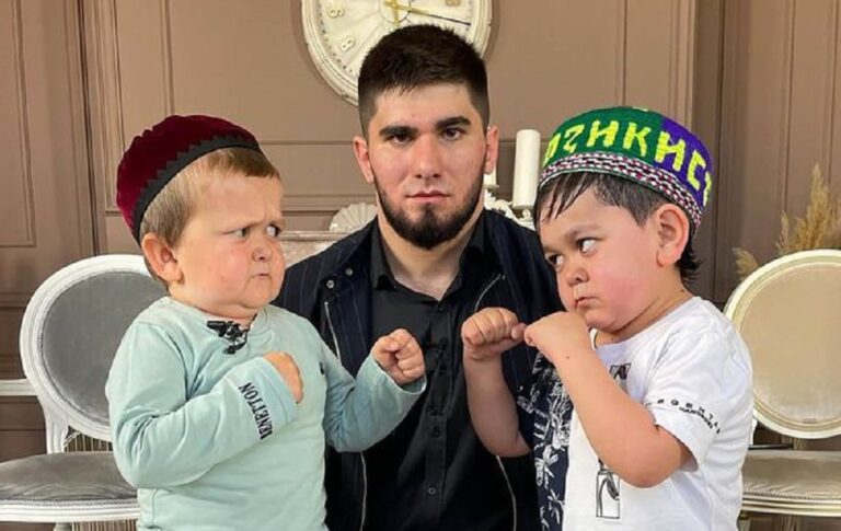 Hasbulla Disease And Illness - What Treatment Is He Getting?