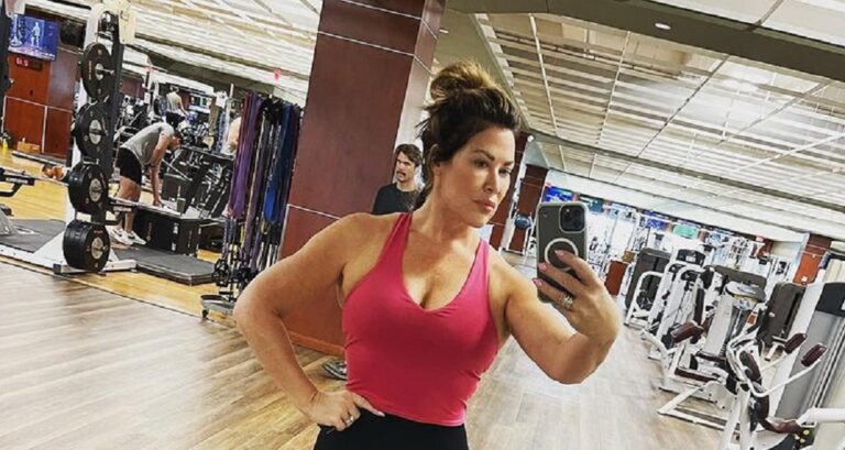 Emily Simpson Before And After Facelift Photos