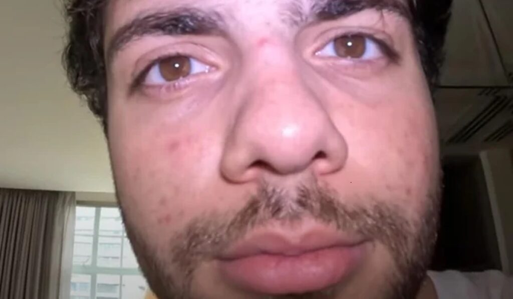 Spoonkid Face Reveal: What Does He Look Like?