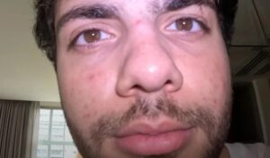 Spoonkid Face Reveal: What Does He Look Like?