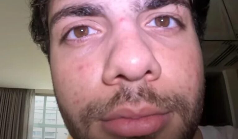 Spoonkid Face Reveal: What Does He Look Like?