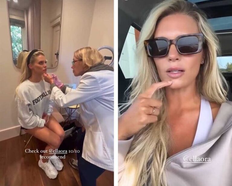 Madison Lecroy Lip Filler Surgery, Before And After Photos